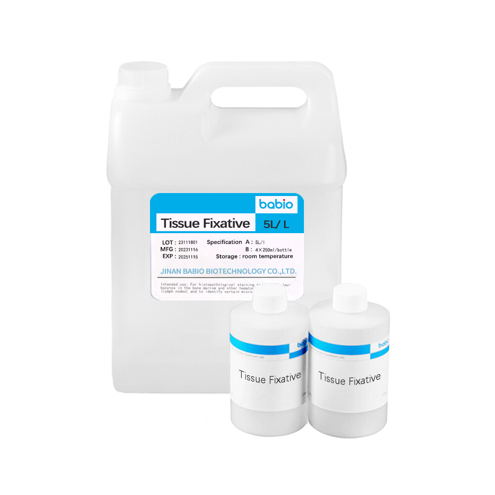 Professional Tissue Fixative for Fresh Tissue Samples - 10% & 13% ...