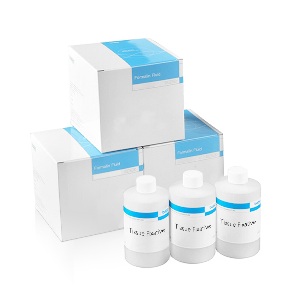 Professional Tissue Fixative for Fresh Tissue Samples - 10% & 13% ...